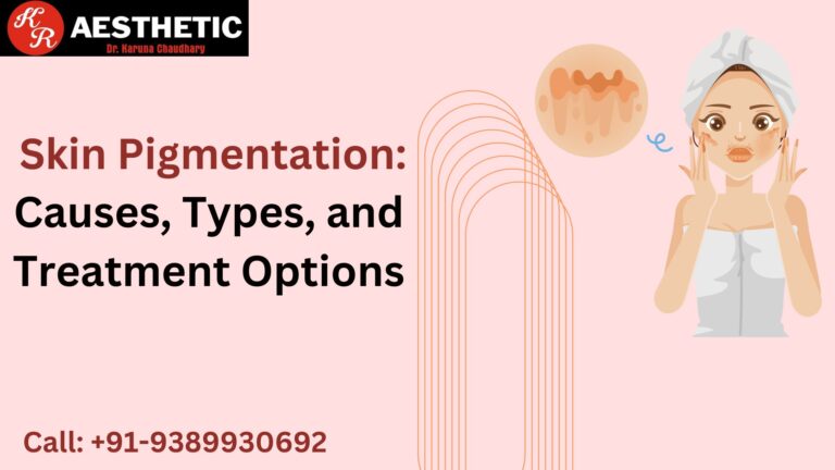 What is Skin Pigmentation: Causes, Types, and Treatment Options